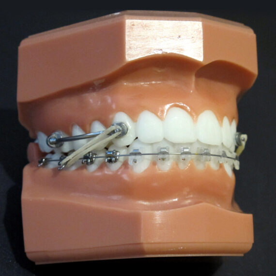 Patient Education at Kamatovic Orthodontics in Niagara