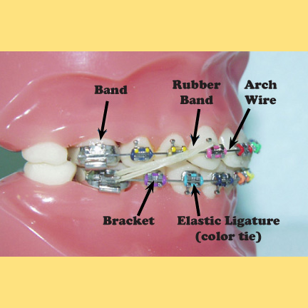 Patient Education at Kamatovic Orthodontics in Niagara